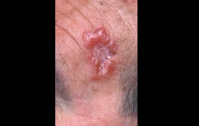 Docplexus