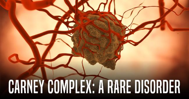 Carney Complex: A Rare Autosomal Disorder