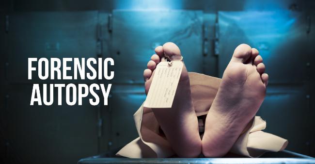 Forensic Autopsy: A Key Medicolegal Investigation