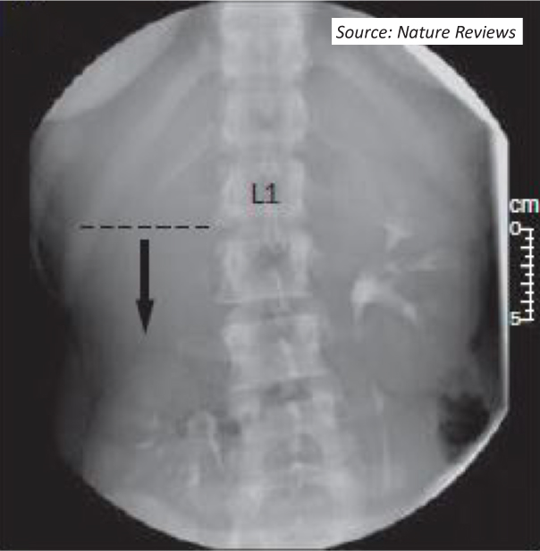 Docplexus
